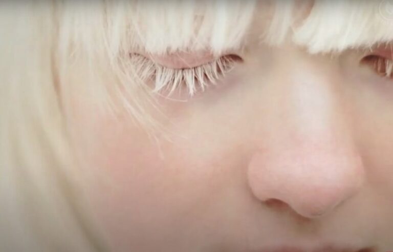 Do eyelashes grow and turn gray? Myths vs. Facts